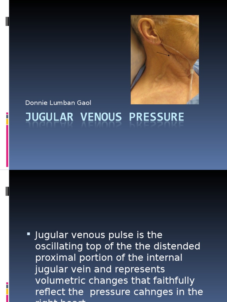 JVP Examination For GP Interna New | PDF | Atrium (Heart) | Vein