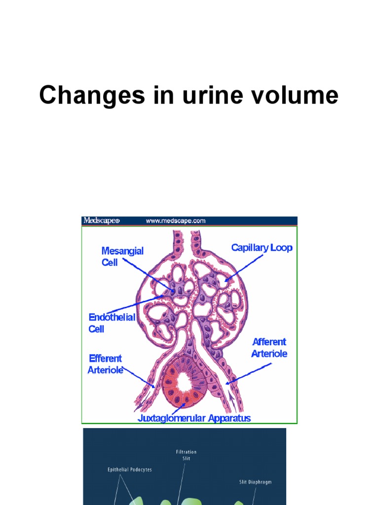 AKI & CKD | Medical | Chronic Kidney Disease