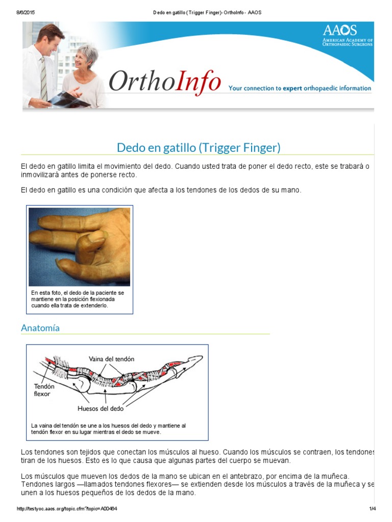 Dedo en Gatillo (Trigger Finger)-OrthoInfo - AAOS