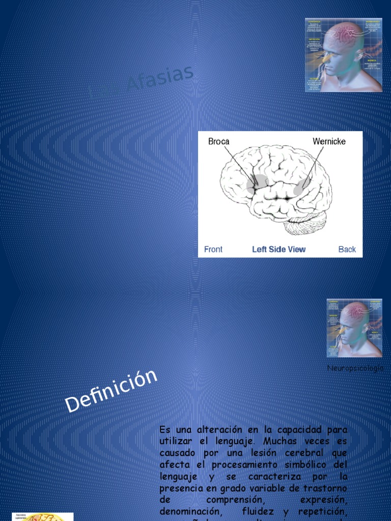 Diapositiva de Afasias | PDF | Afasia | Neuropsicología