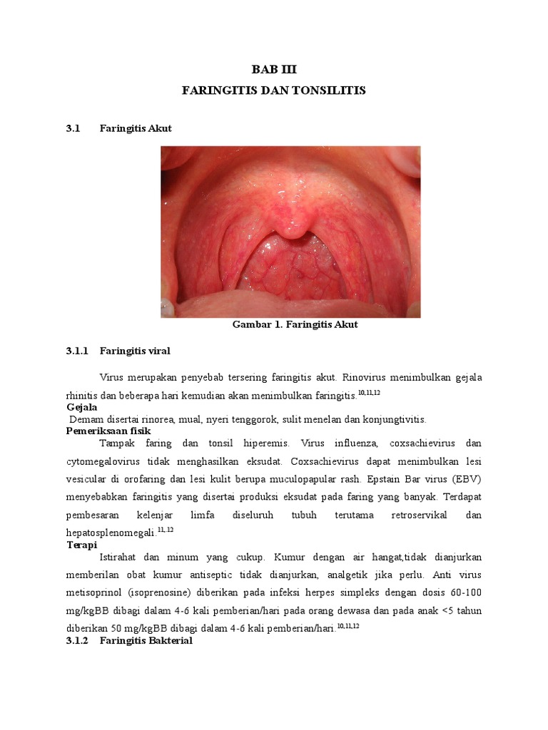 Bab III Tonsilofaringitis | PDF