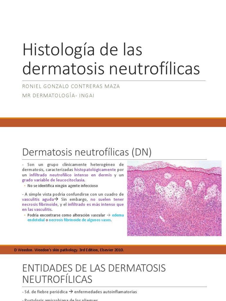 Histología de Las Dermatosis Neutrofílicas | PDF | Condiciones cutáneas ...