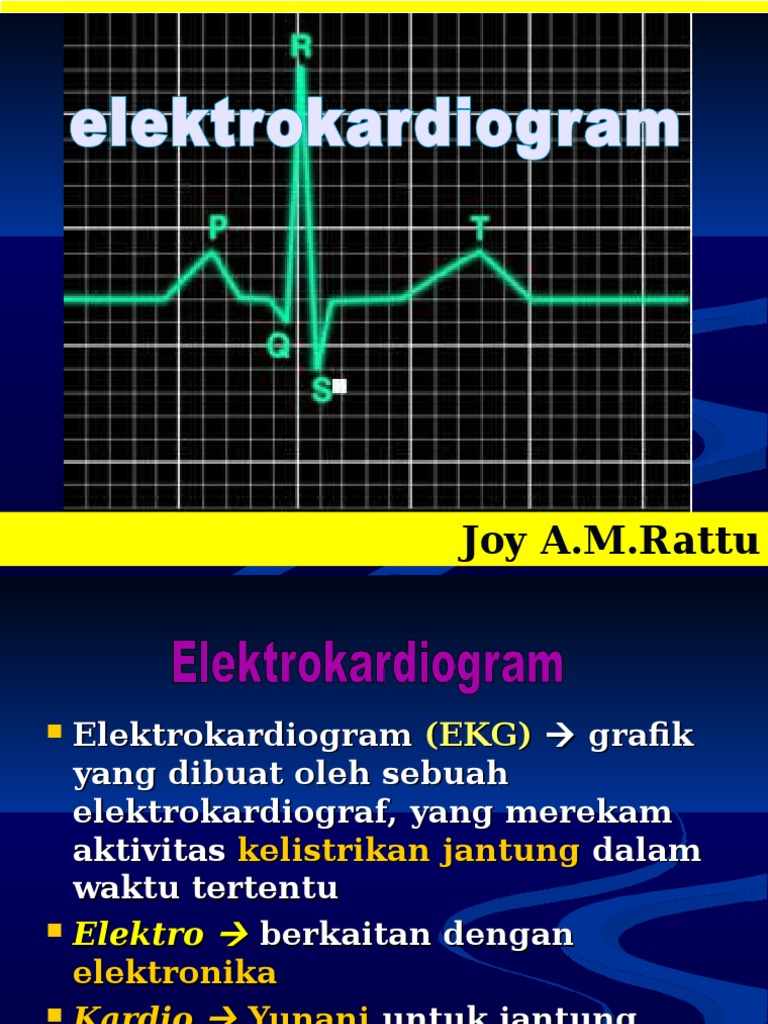 cara mudah baca EKG