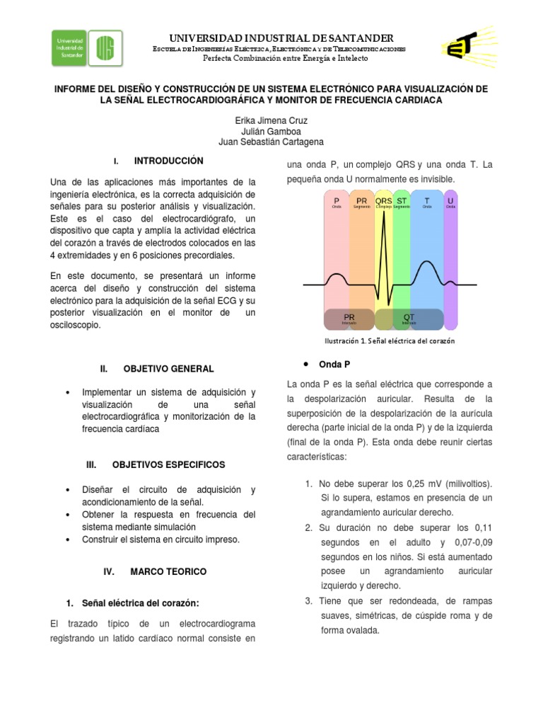 Informe ECG | PDF | Electrocardiografia | Ingenieria Eléctrica