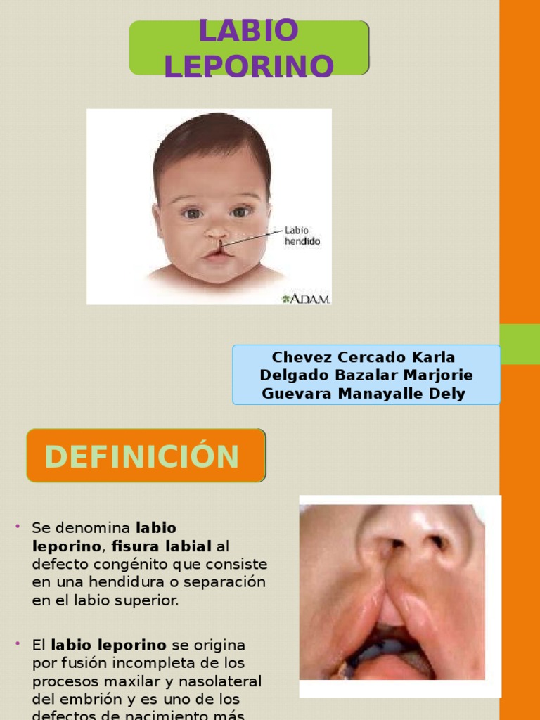 Labio Leporino | PDF | Salud y bienestar