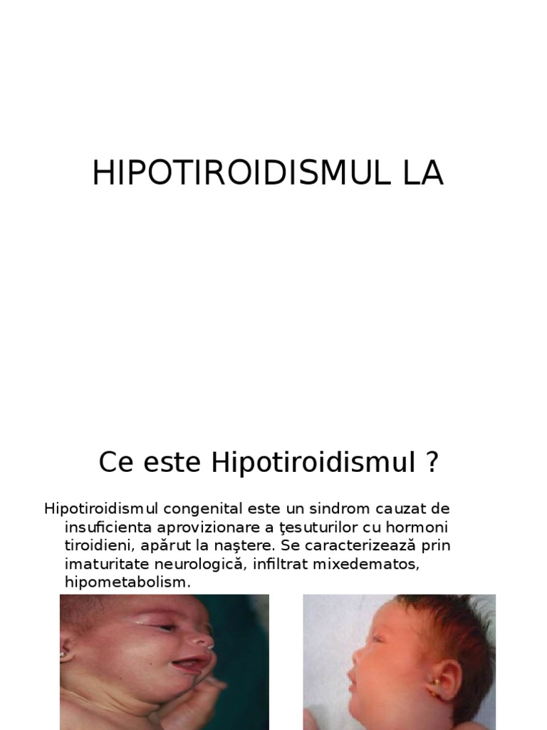 Ce Este Hipotiroidismul | PDF
