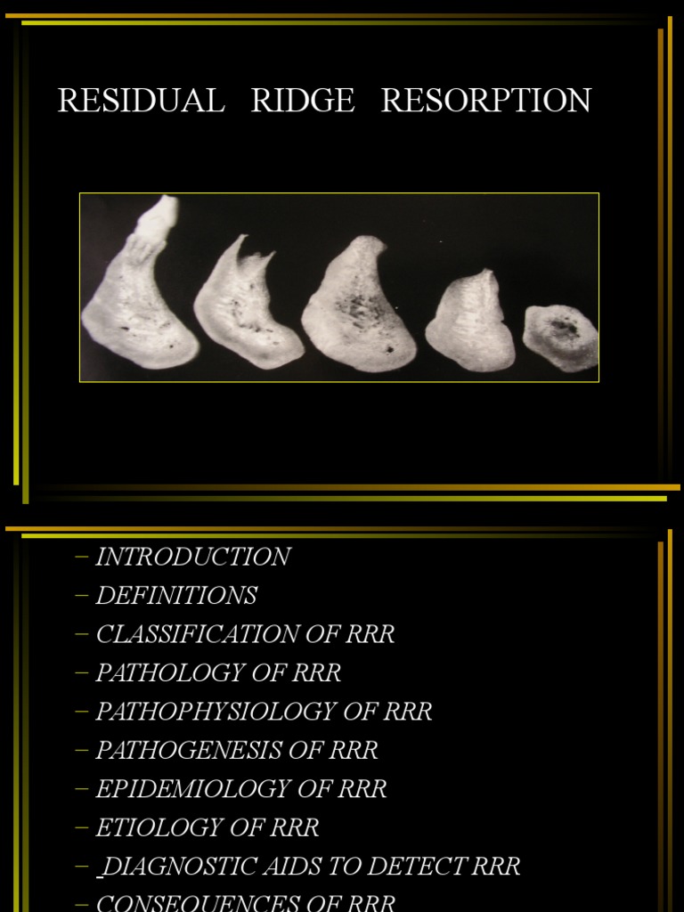 Residual Ridge Resorption | PDF | Dental Implant | Bone