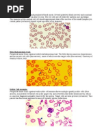 Tumbling E Eye Chart Instructions | PDF