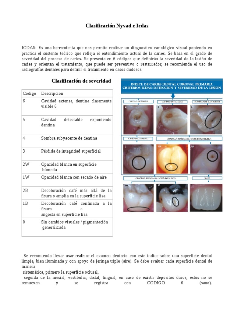 Nyvad e Icdas | PDF | Esmalte de dientes | Diente humano