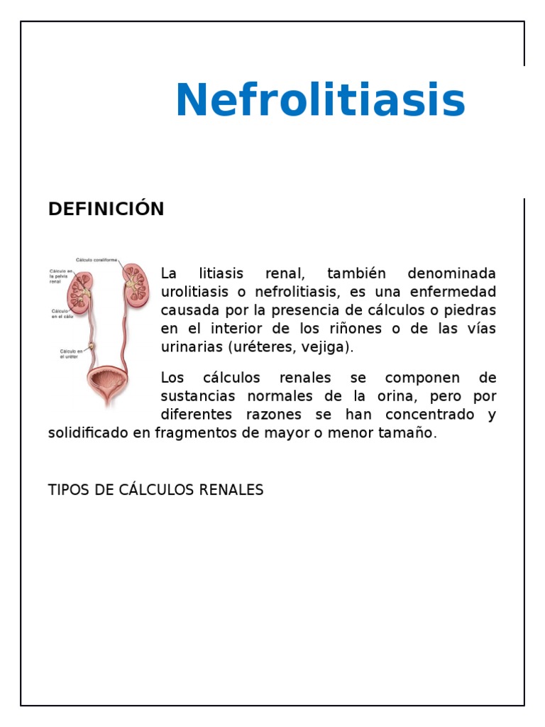 Nefrolitiasis Word | PDF | Urología | Medicina