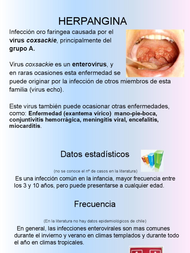 Herpangina In Adults
