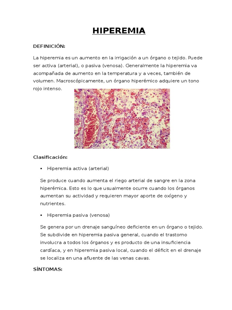 Tipos y causas de hiperemia | PDF | Ciencia y matemáticas