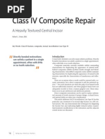 Class V Composite Preparation and Restoration On Human Toothpdf | PDF ...