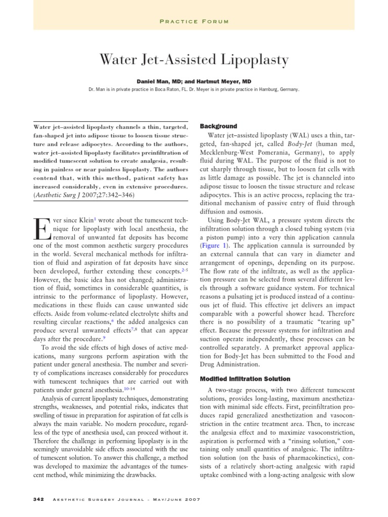 Water Jet Assisted Lipoplasty | PDF | Anesthesia | Surgery