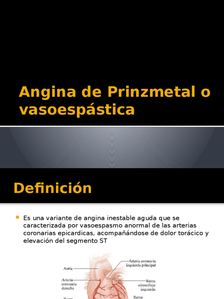 Angina de Prinzmetal o Vasoespástica | PDF