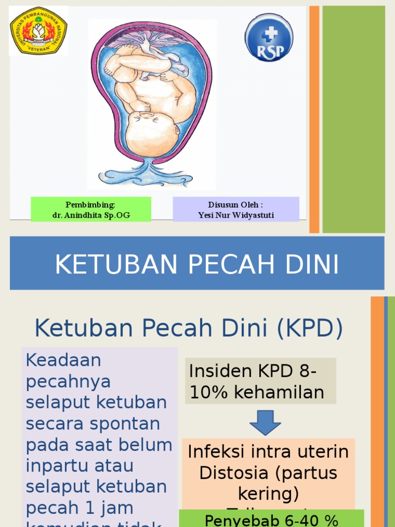 KPD | PDF