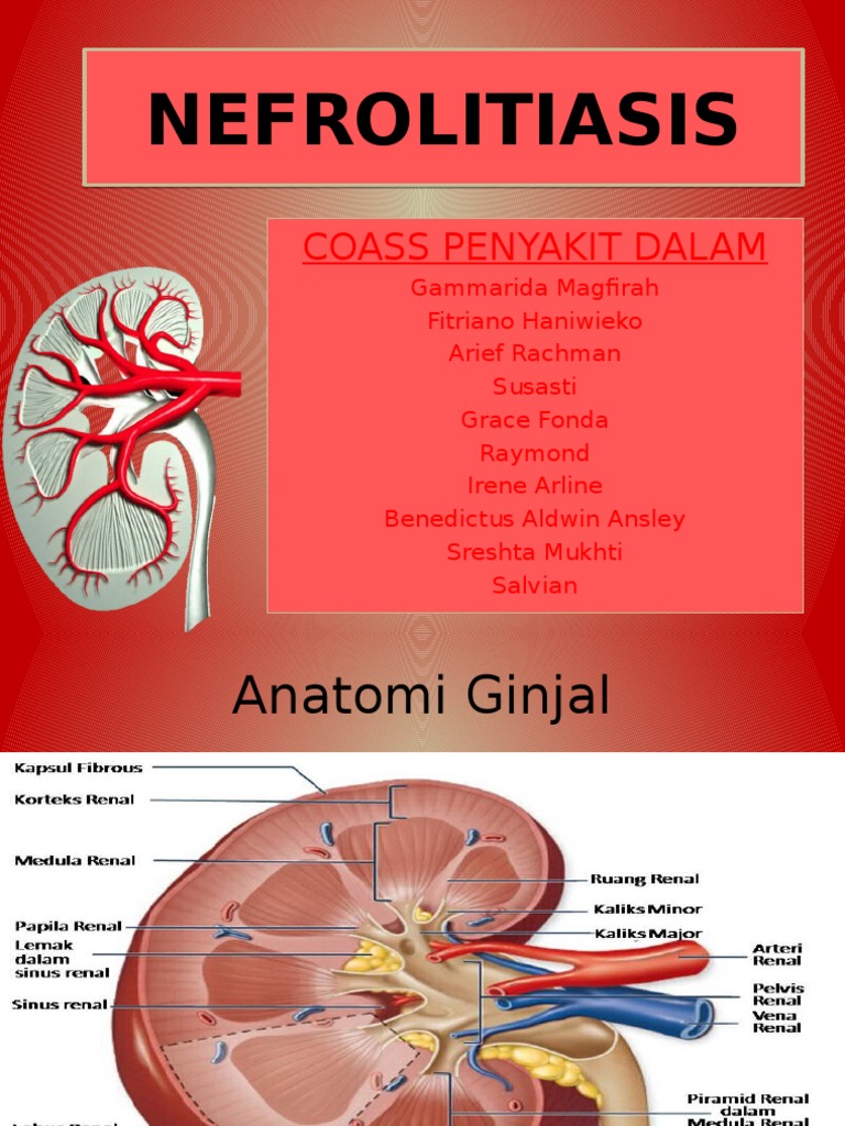 Nefrolitiasis | PDF | Kesehatan Holistik