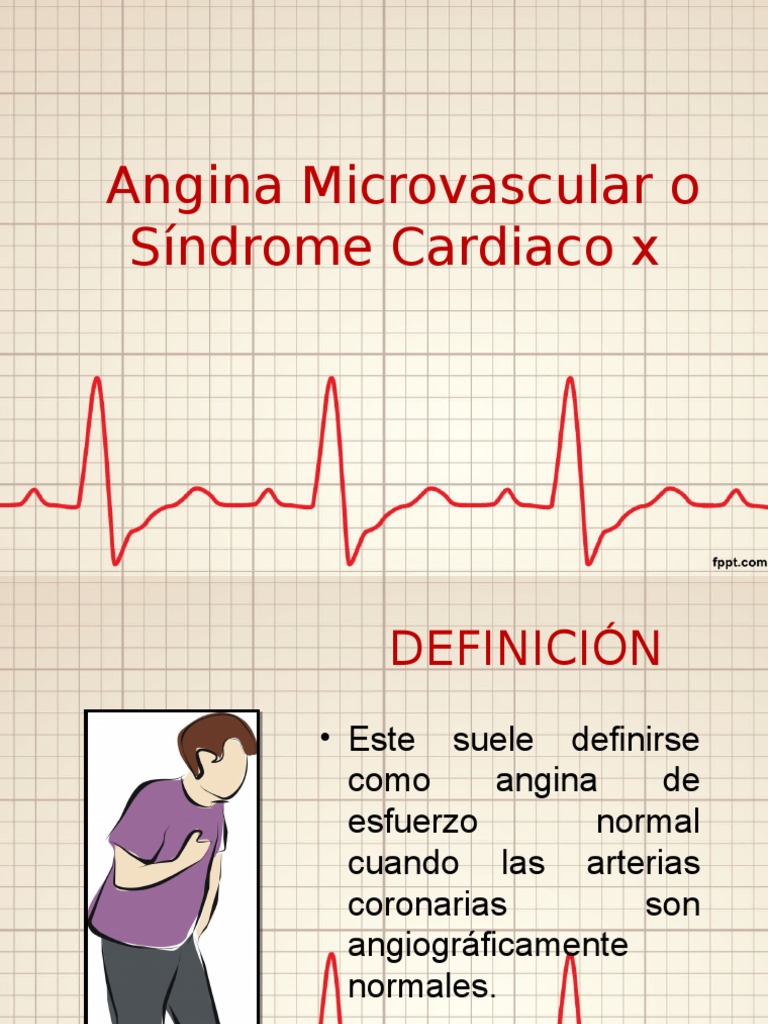 Angina Microvascular | PDF | Angina de pecho | Isquemia
