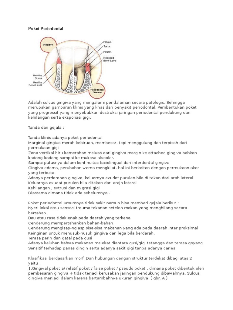 Poket Periodontal | PDF