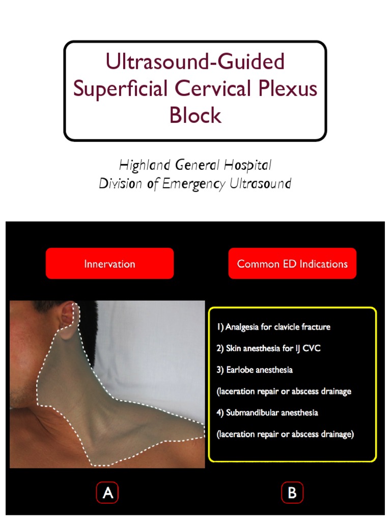 SCP Block How To | PDF