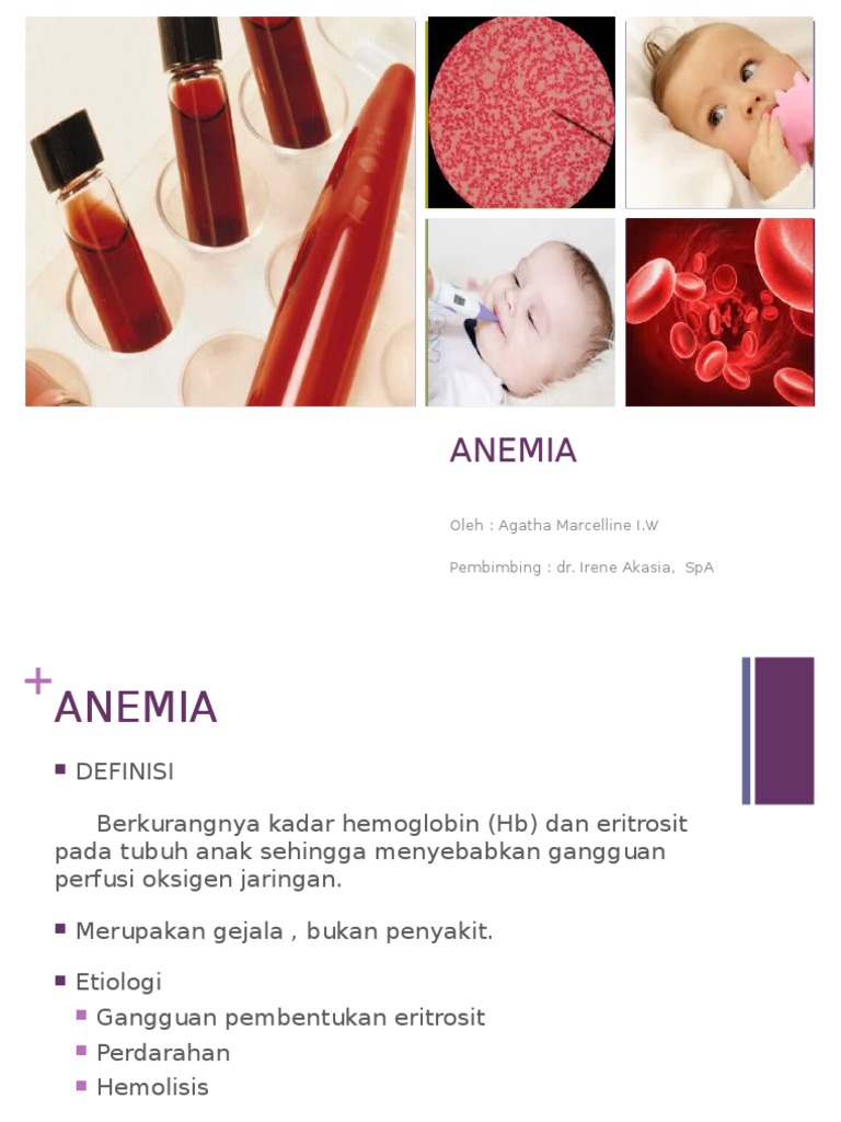 Anemia Anak | PDF