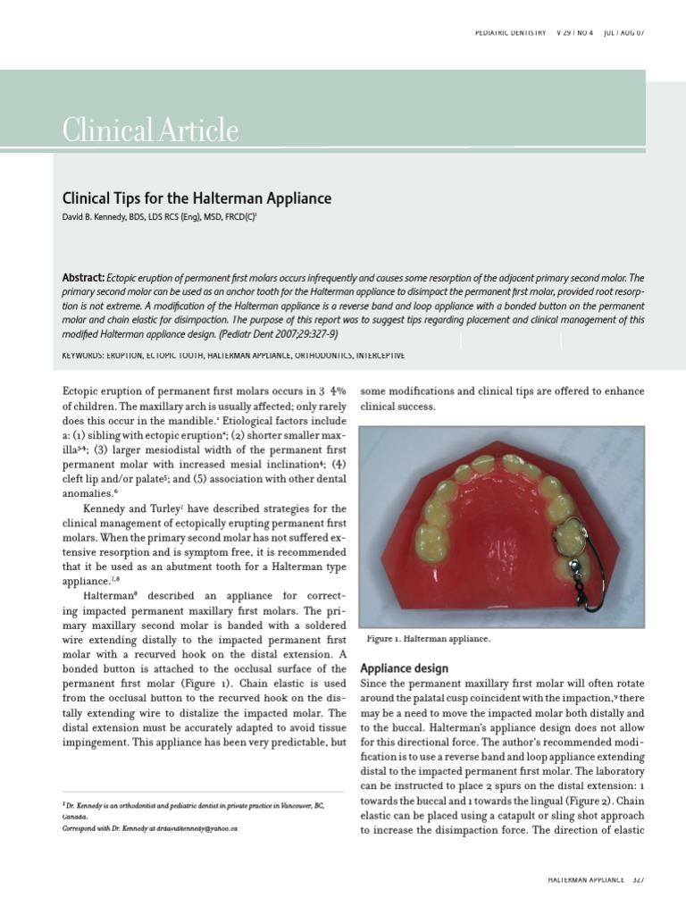 Clinical Tips For Halterman Appliance | PDF | Dentistry | Mouth