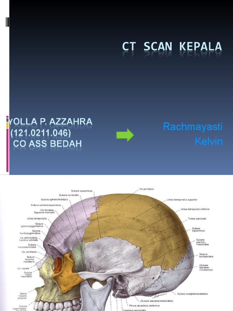 CT Scan Kepala Emergency | PDF