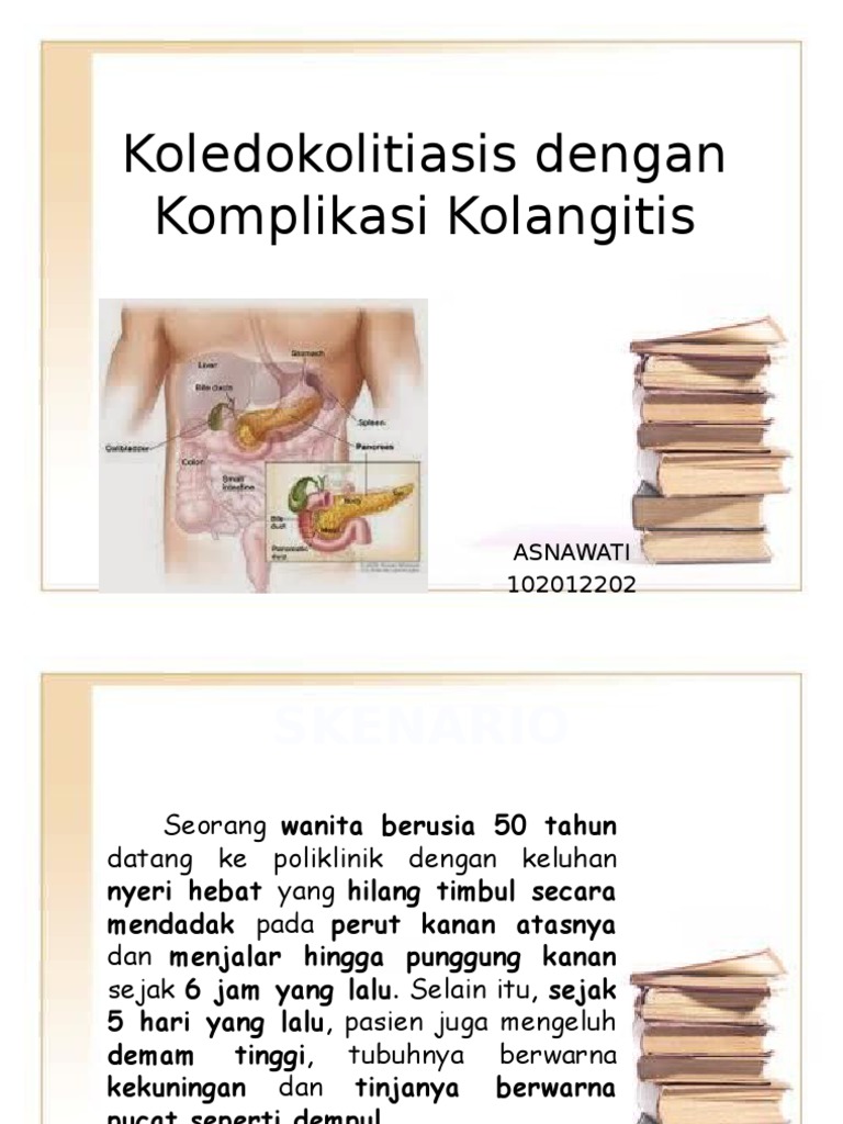 Koledokolitiasis Dengan Komplikasi Kolangitis | PDF