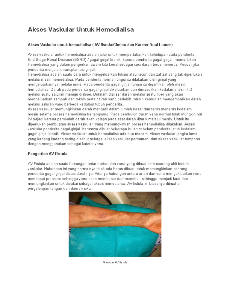 Akses Vaskular Untuk Hemodialisa | PDF | Teknologi & Rekayasa
