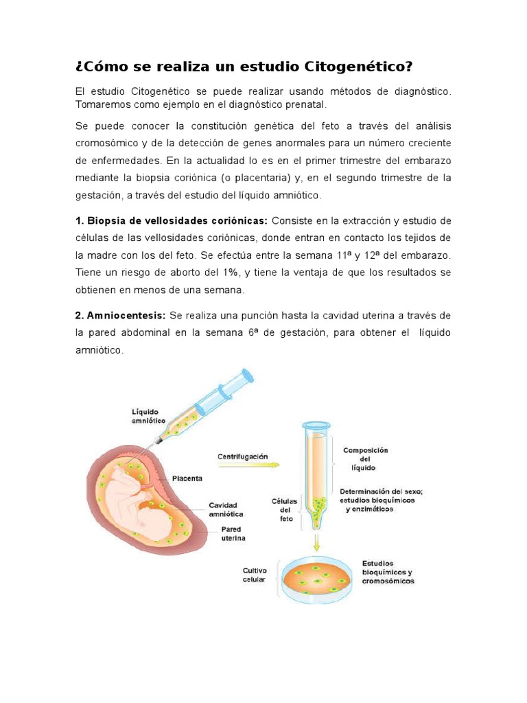 ¿Cómo se realiza un estudio Citogenético?: 1. Biopsia de vellosidades ...