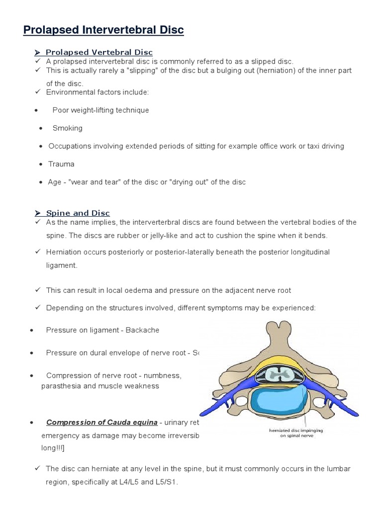 Prolapsed Intervertebral Disc Complete | Clinical Medicine | Diseases ...