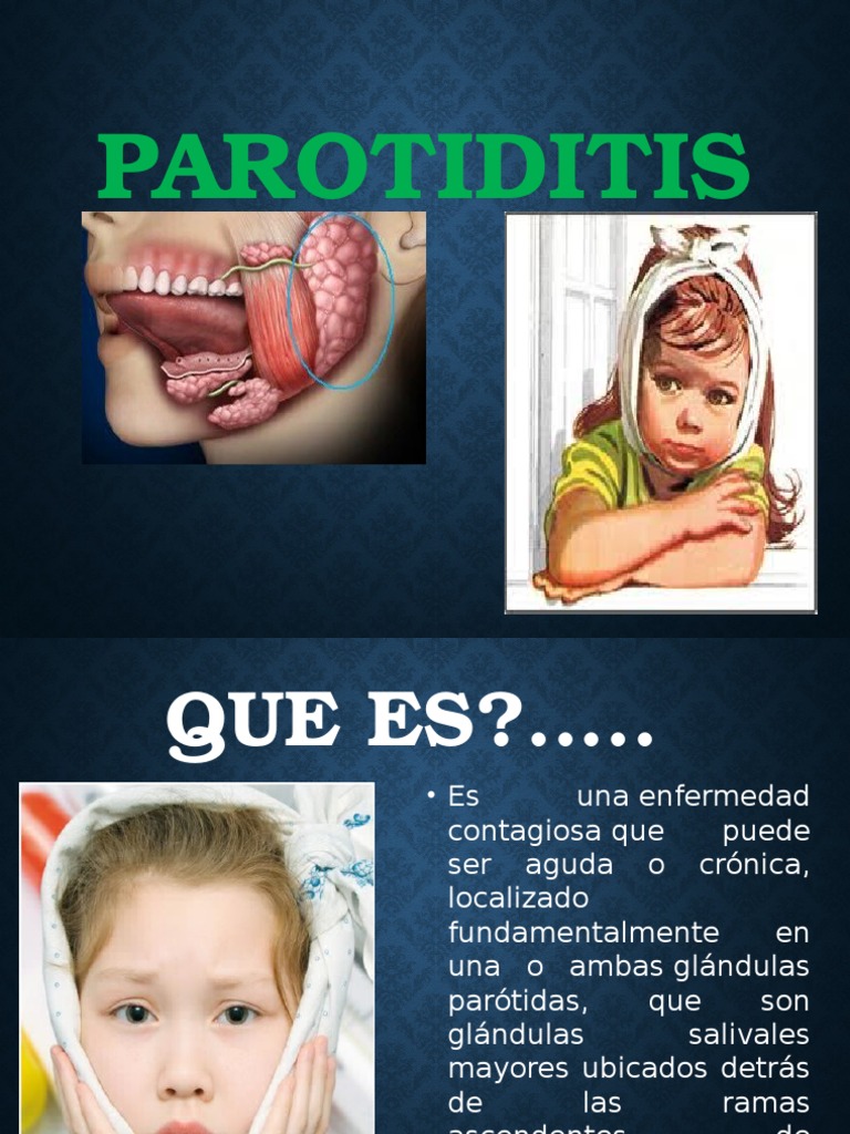 PAROTIDITIS | PDF | Especialidades Medicas | Enfermedades y trastornos