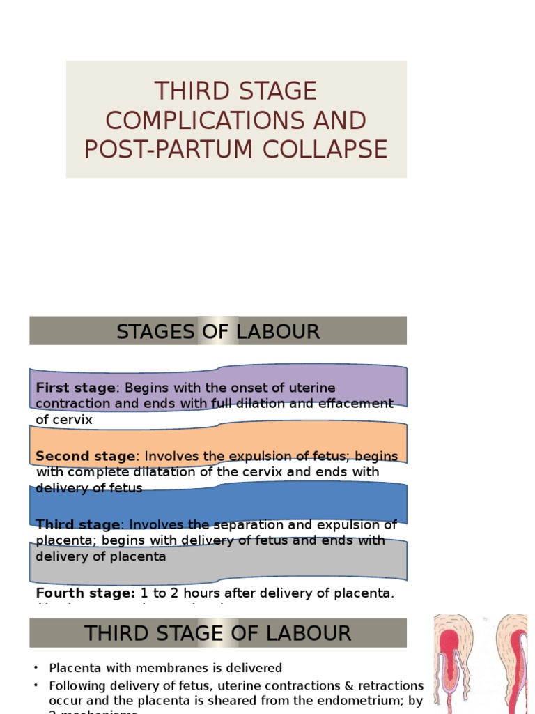 Third Stage Complications and Post-Partum Collapse | PDF | Placenta | Childbirth