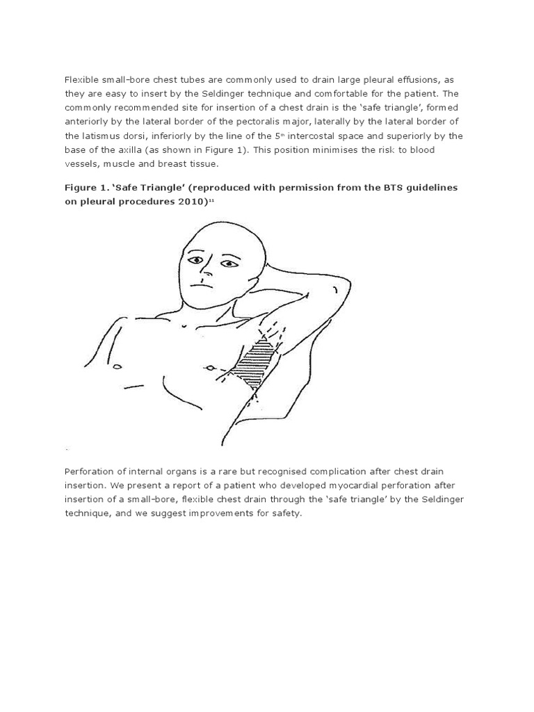 Triangle of Safety | PDF