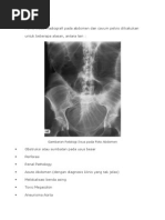 Prosedur Rontgen Abdomen 3 Posisi | PDF