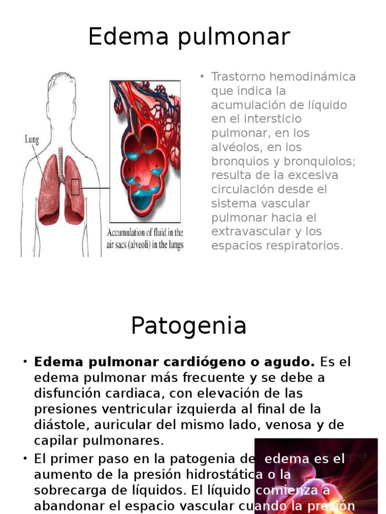 Edema Pulmonar | Edema | Pulmón