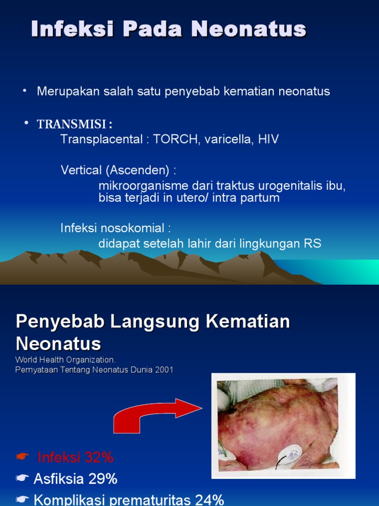 Infeksi Pada Neonatus | PDF