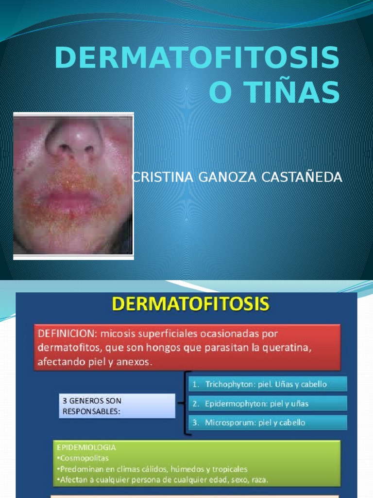 Exp Dermatofitosis o Tiñas | PDF | Enfermedades animales | Epidemiología