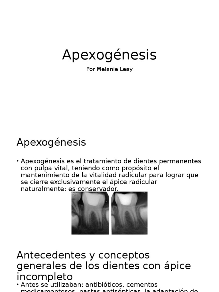 Apexogénesis | Diente humano | Calcio