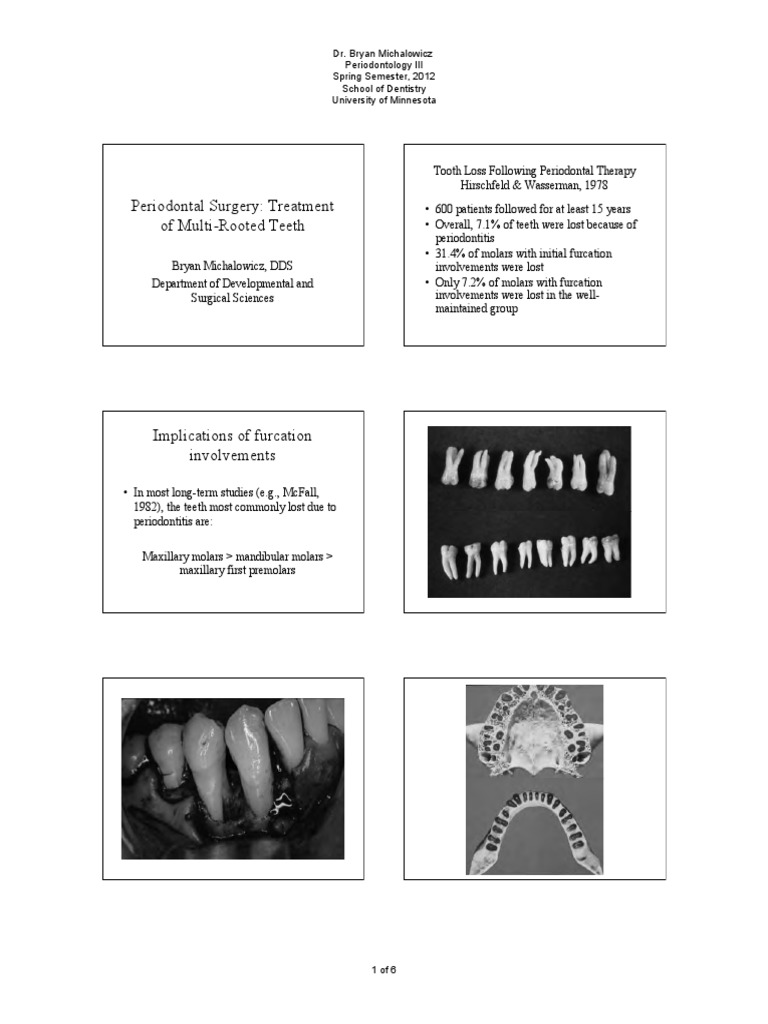 Periodontal Surgery: Treatment of Multi-Rooted Teeth | PDF | Dentistry ...