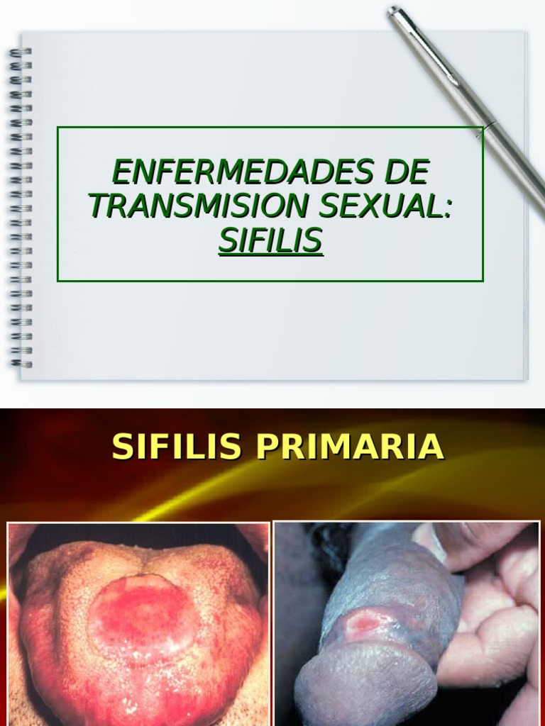 Sifilis Genital
