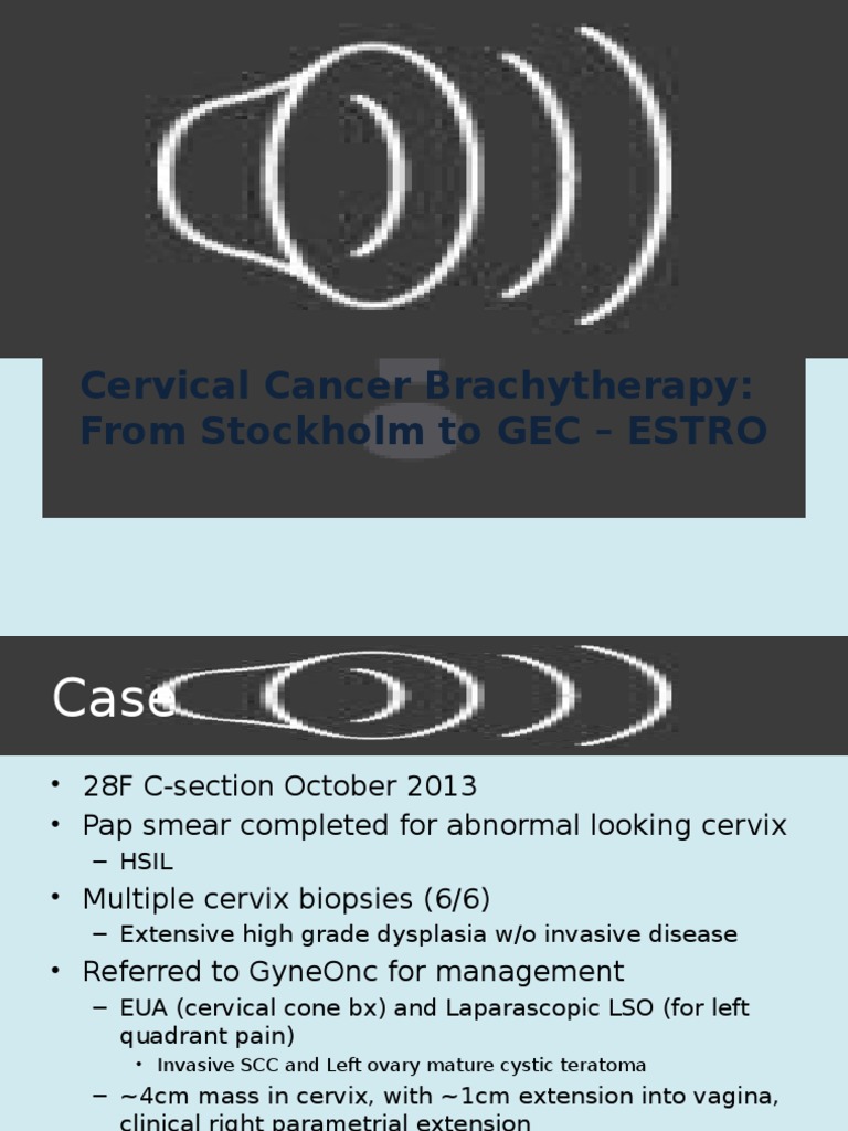 Cervix Gec Estro | PDF | Radiation Therapy | Cervical Cancer