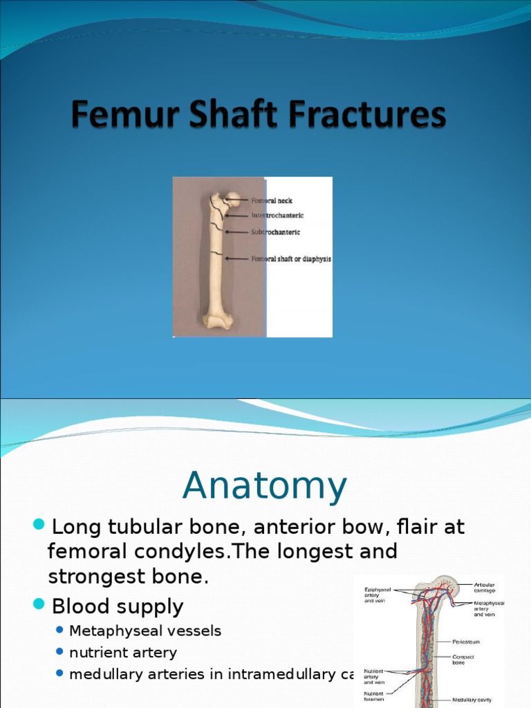 Femur Fracture Overview and Management | PDF | Knee | Limbs (Anatomy)
