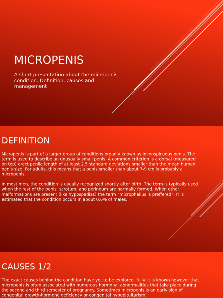 Understanding Micropenis: Causes & Treatment | PDF | Sexual Anatomy ...