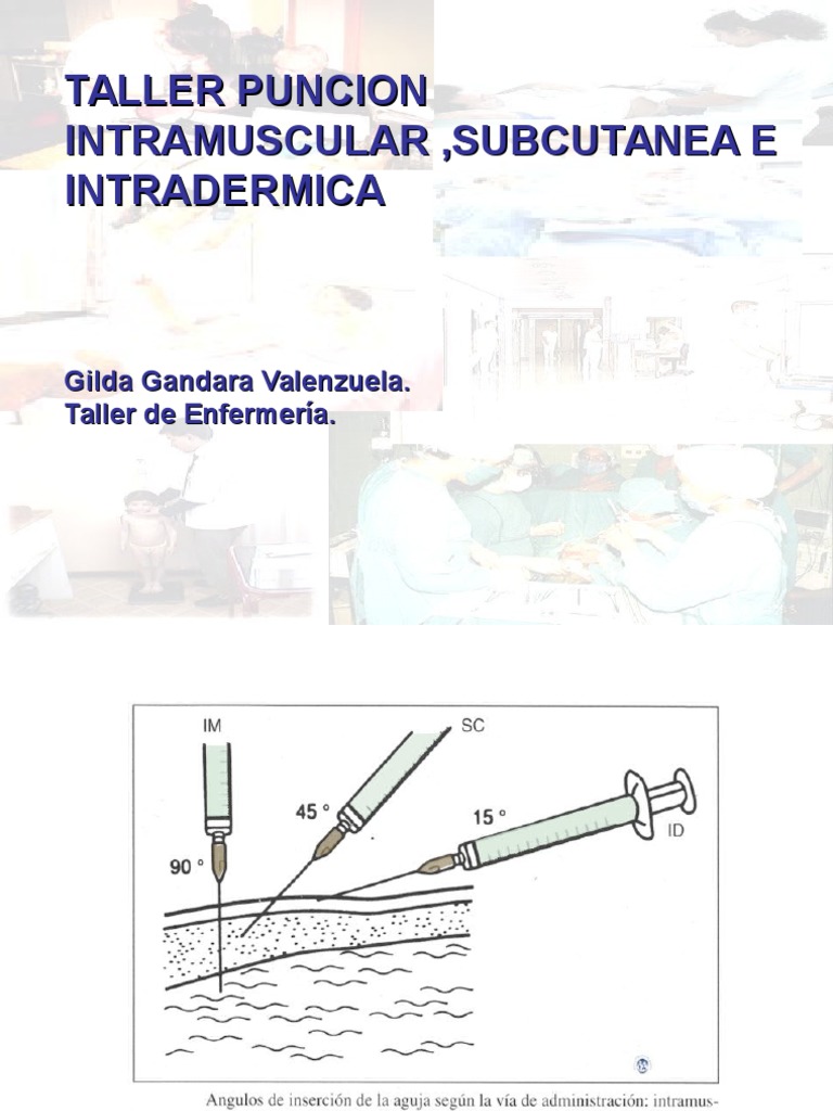 Técnicas de Punción en Enfermería | PDF | Terapia intravenosa | Jeringuilla
