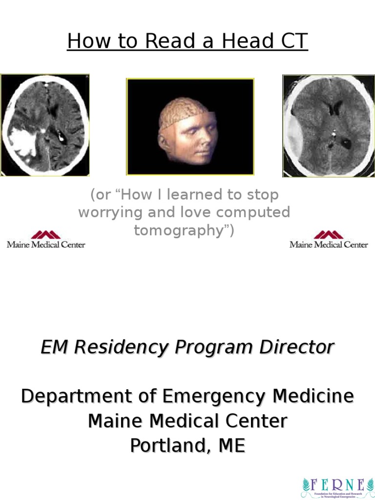 How To Read A Head CT: (Or "How I Learned To Stop Worrying and Love ...