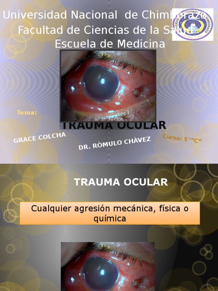 Trauma Ocular | PDF | Herida | Ojo humano