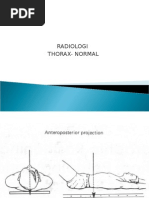 Anatomi Thorax Normal + Gambaran Radiologi | PDF