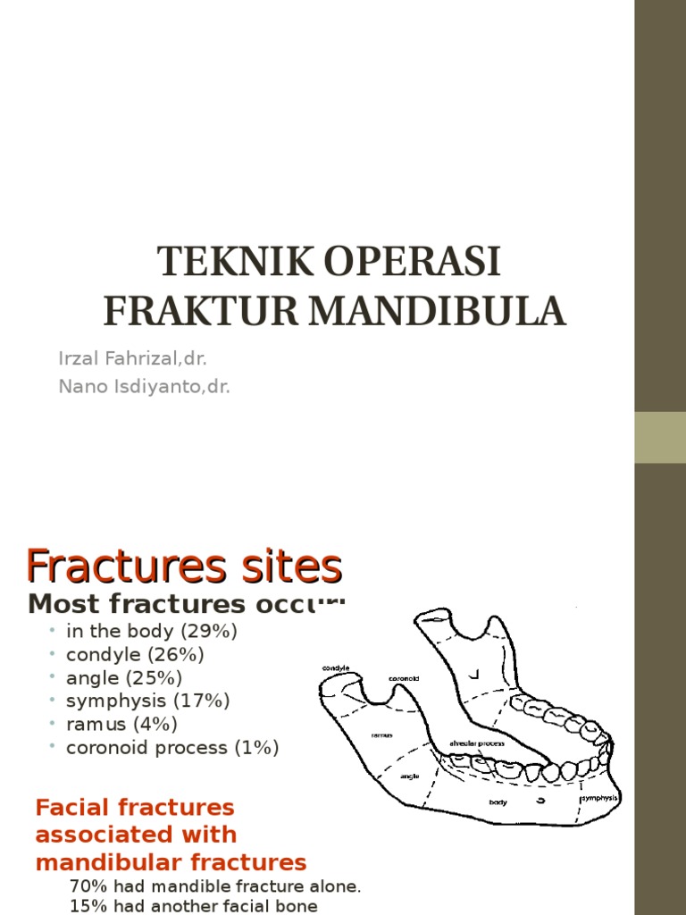 Teknik Operasi Fraktur Mandibula | PDF