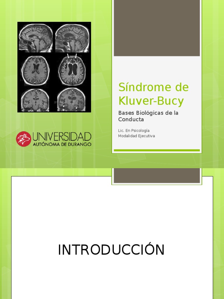 Síndrome de Klüver-Bucy: Síntomas y Causas | PDF | Amígdala | Las emociones